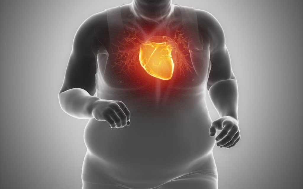 Understanding the Health Issues with Overweight and Obesity